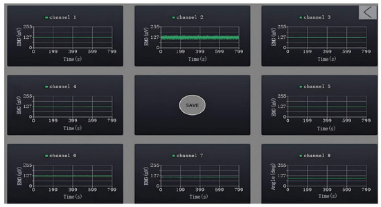 Design and Analysis of an Upper Limb Rehabilitation Robot Based on ...