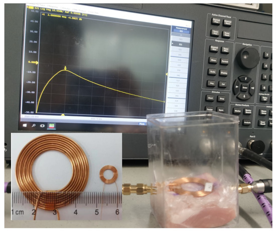 Minimally Invasive Hypoglossal Nerve Stimulator Enabled by ECG Sensor ...
