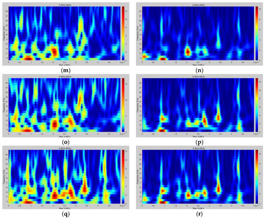 A Combined Virtual Electrode-Based ESA and CNN Method for MI-EEG Signal ...