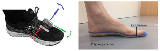 Sensors | Free Full-Text | Effect of Foot Orthoses on Angular Velocity ...