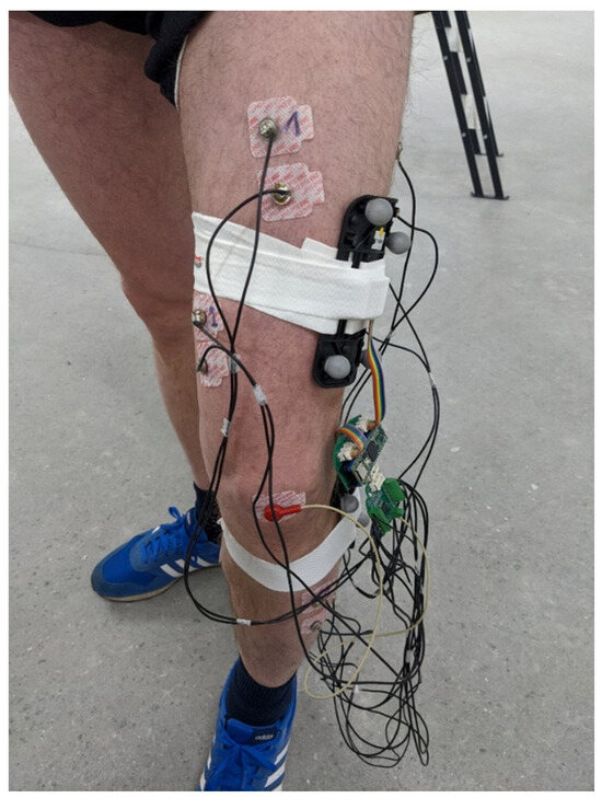 An Integrated Approach for Real-Time Monitoring of Knee Dynamics with ...