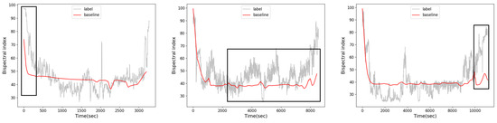 A Deep Learning Framework for Anesthesia Depth Prediction from Drug Infusion History