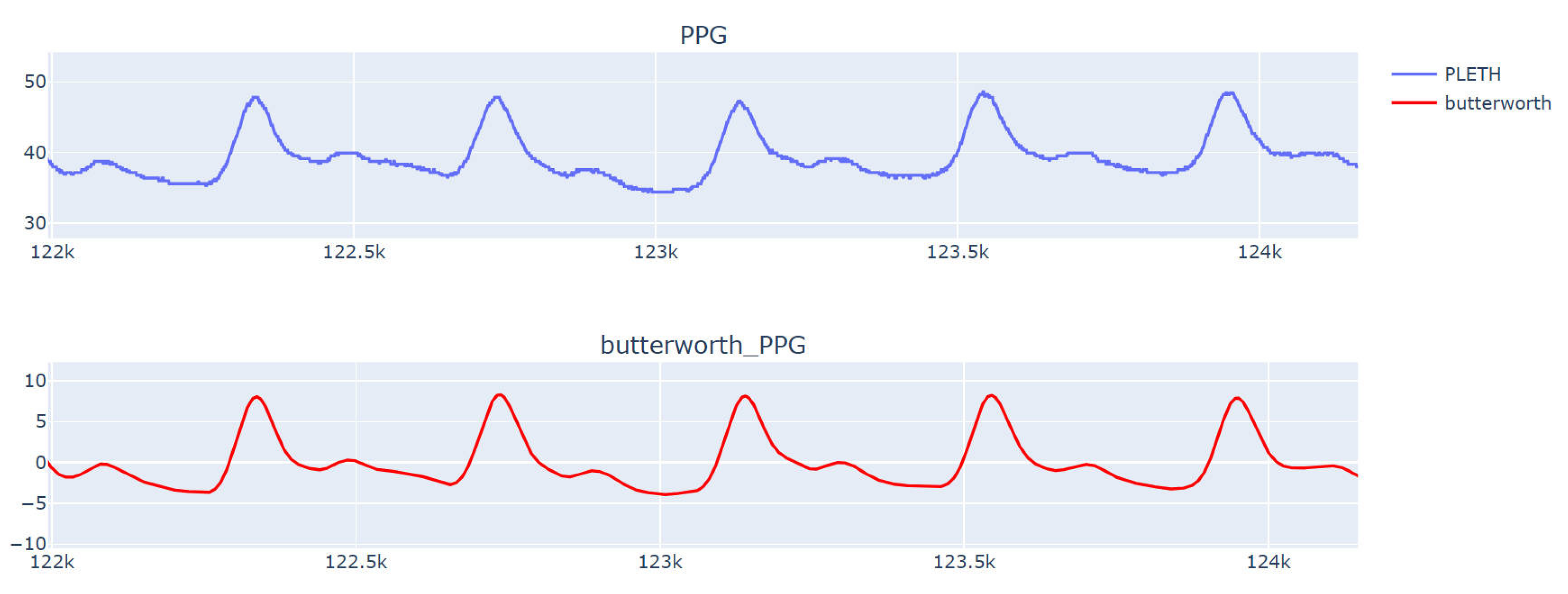 Improved U-Net Model to Estimate Cardiac Output Based on ...