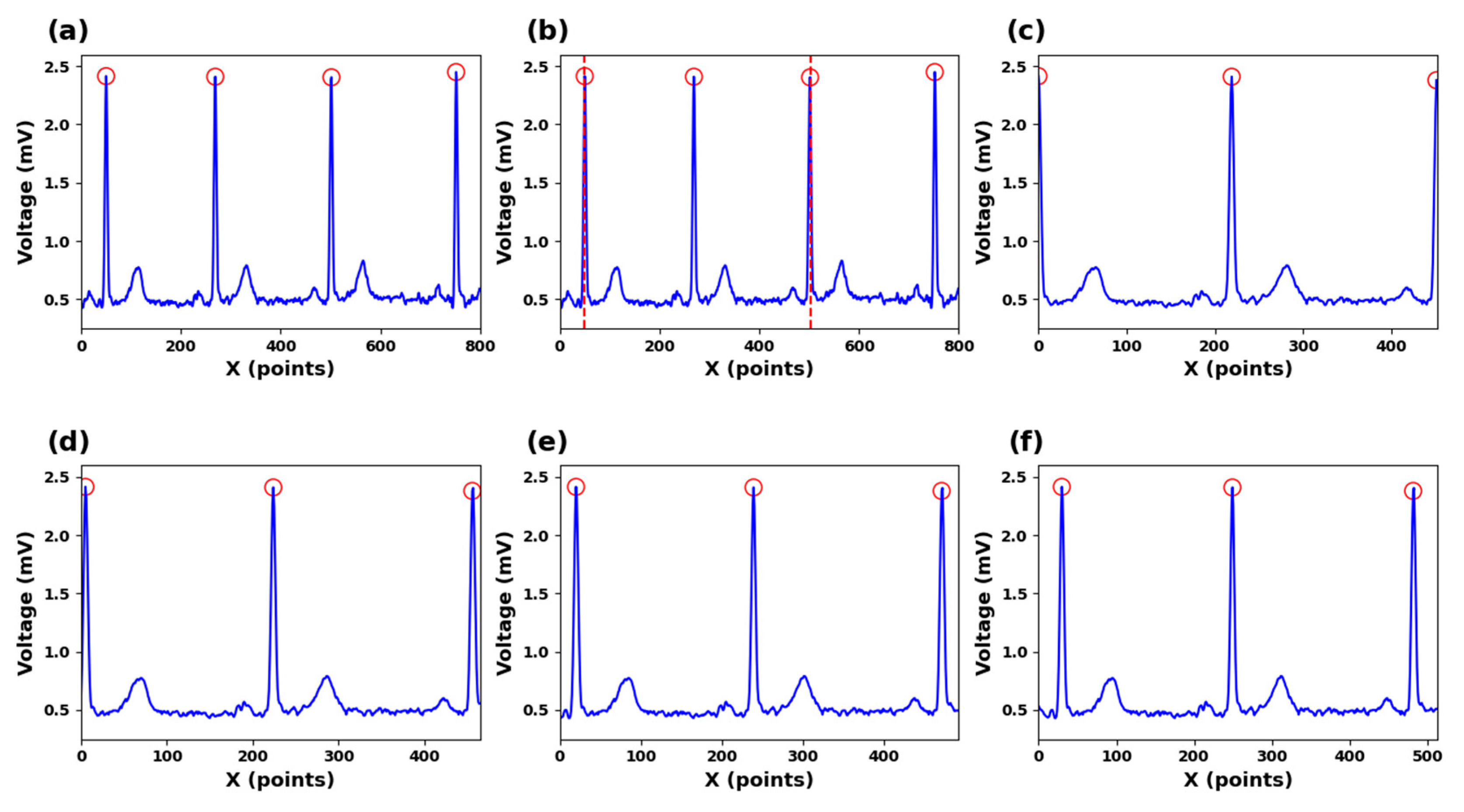 Electrocardiogram-Based Biometric Identification Using Mixed Feature ...