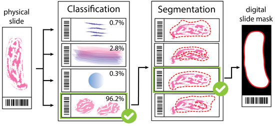 Artifact Augmentation for Enhanced Tissue Detection in Microscope ...