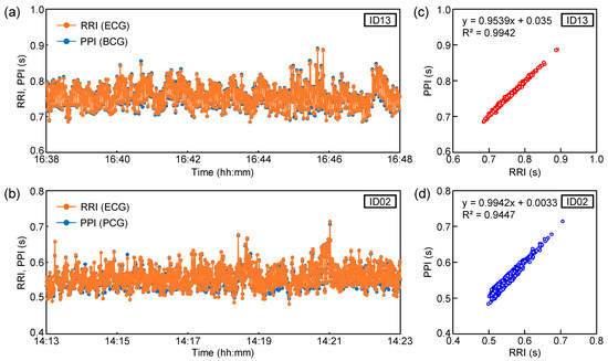 Unobstructive Heartbeat Monitoring of Sleeping Infants and Young ...