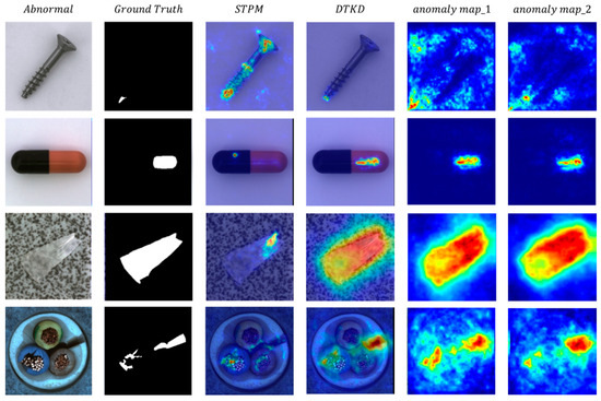 A Method for Image Anomaly Detection Based on Distillation and Reconstruction