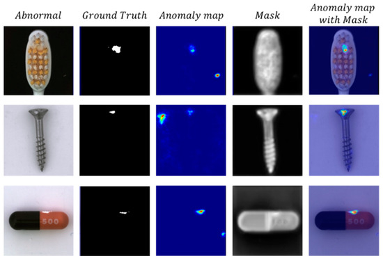 A Method for Image Anomaly Detection Based on Distillation and Reconstruction