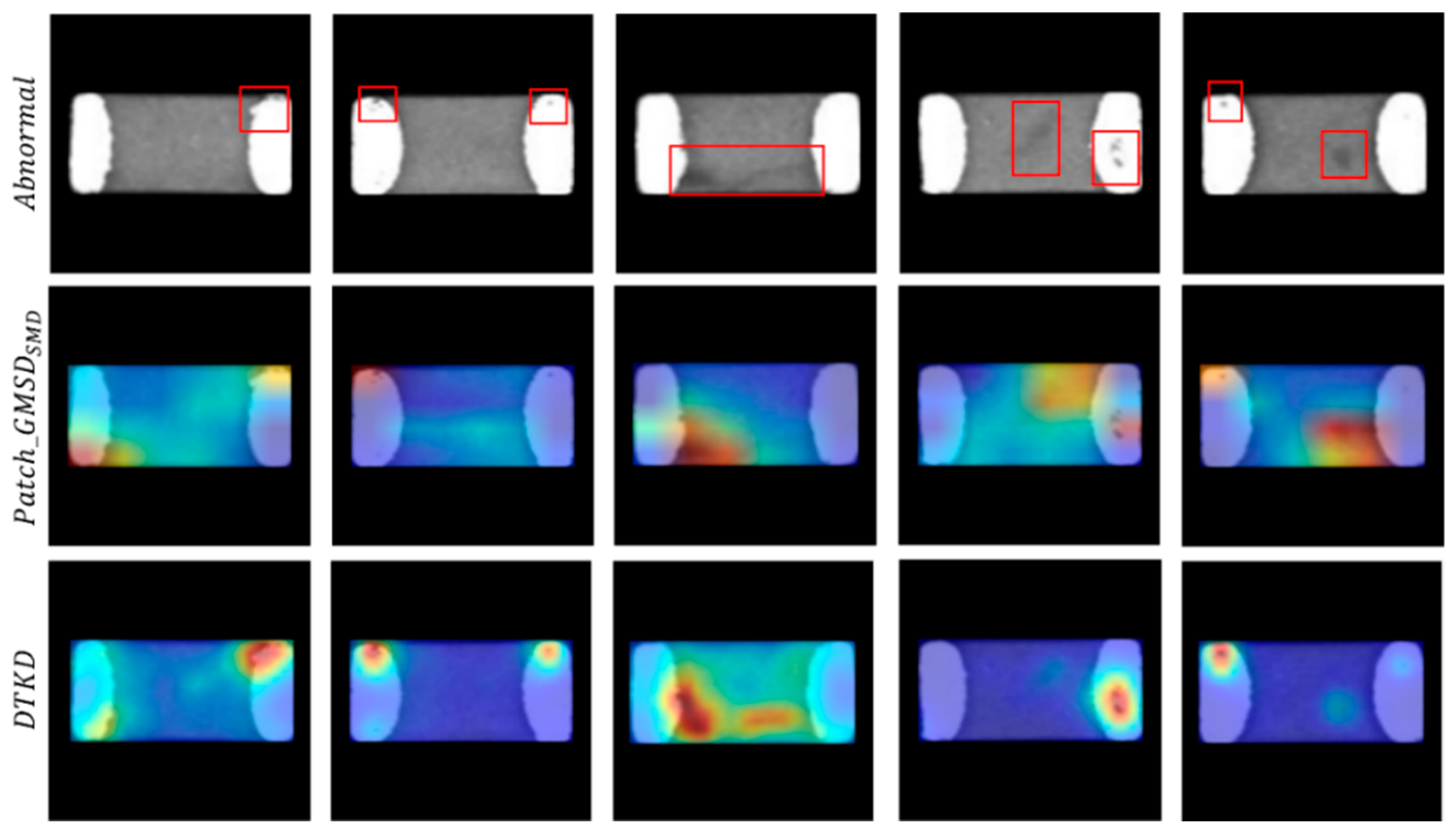 A Method for Image Anomaly Detection Based on Distillation and ...