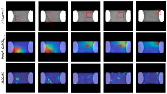 A Method for Image Anomaly Detection Based on Distillation and ...