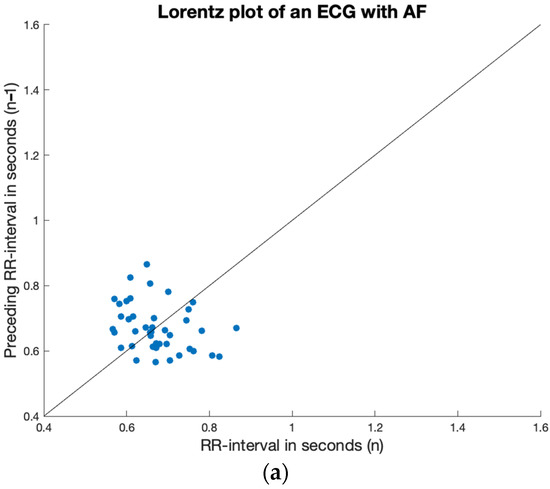 Sensors | Free Full-Text | Improving Automatic Smartwatch Electrocardiogram Diagnosis of Atrial ...