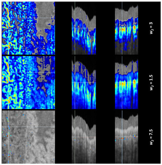Tail Artifact Removal via Transmittance Effect Subtraction in Optical ...