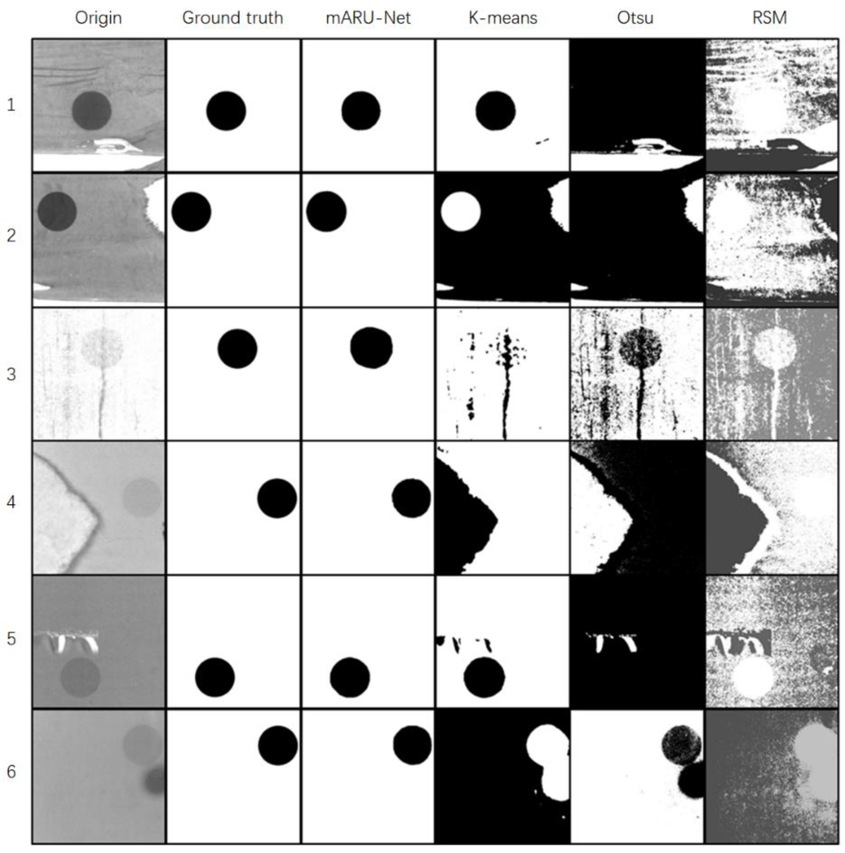 Image Segmentation of Fiducial Marks with Complex Backgrounds Based on the mARU-Net