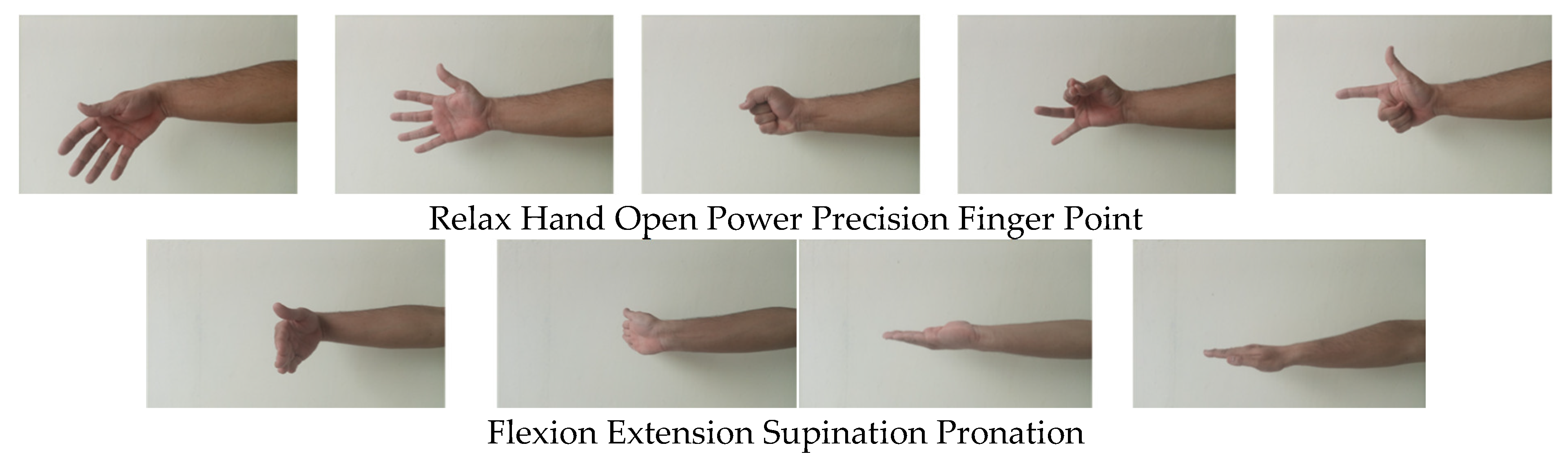 Sensors | Free Full-Text | A Wearable Force Myography-Based Armband for ...