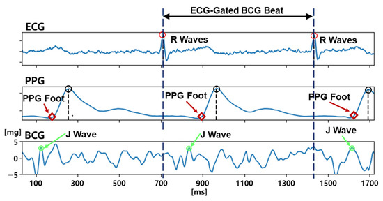 BCG Signal Quality Assessment Based on Time-Series Imaging Methods