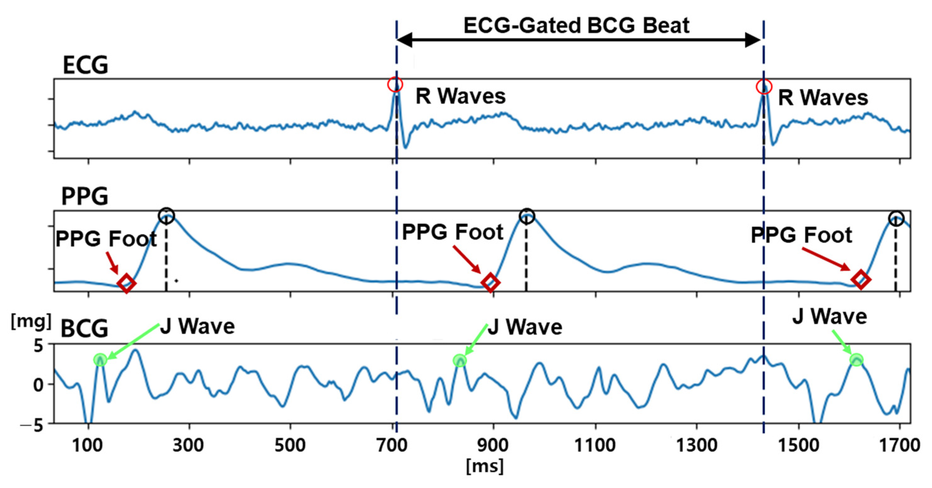 BCG Signal Quality Assessment Based on Time-Series Imaging Methods