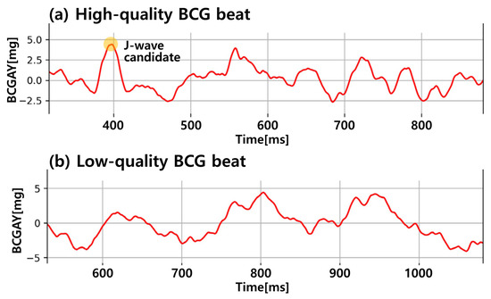 BCG Signal Quality Assessment Based on Time-Series Imaging Methods