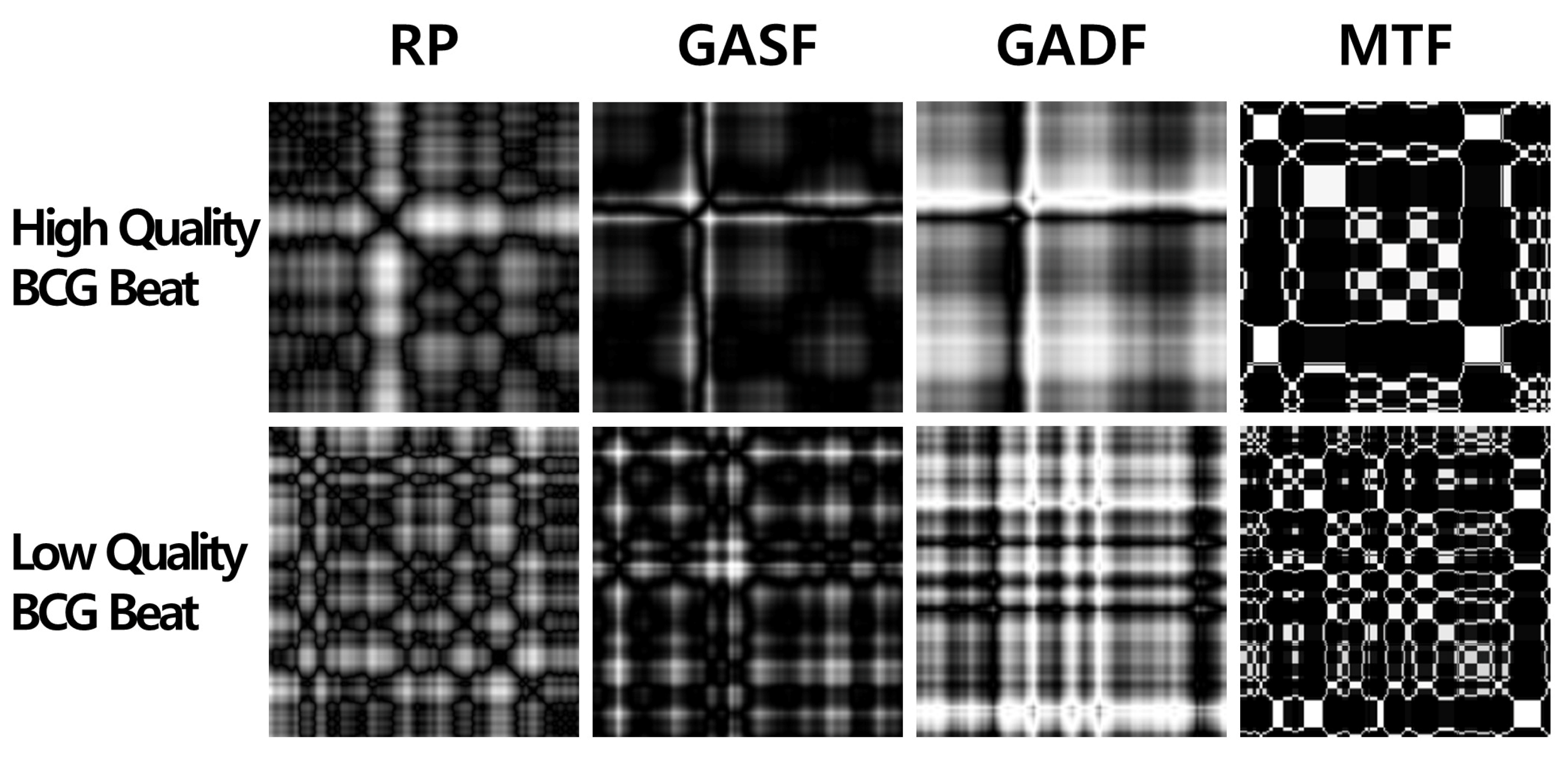 BCG Signal Quality Assessment Based on Time-Series Imaging Methods