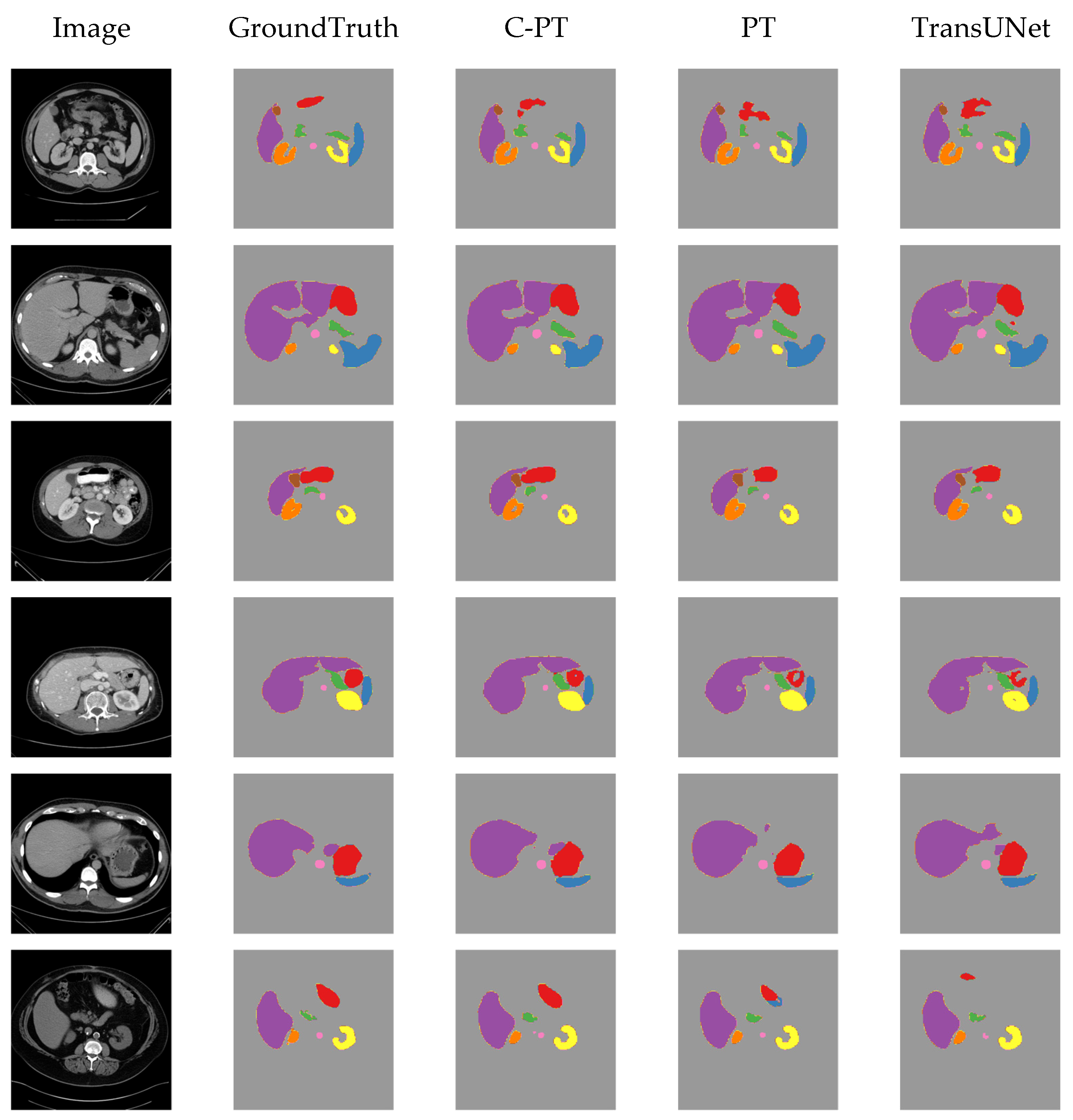 Sensors | Free Full-Text | Cross-Parallel Transformer: Parallel ViT for ...