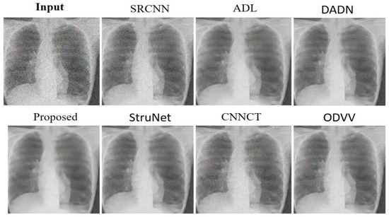 Enhancing Medical Image Denoising with Innovative Teacher–Student Model ...