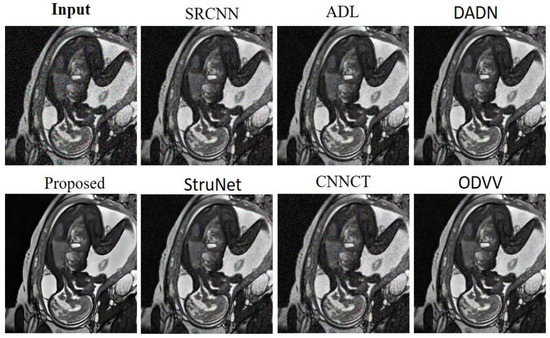 Sensors | Free Full-Text | Enhancing Medical Image Denoising with Innovative Teacher–Student ...