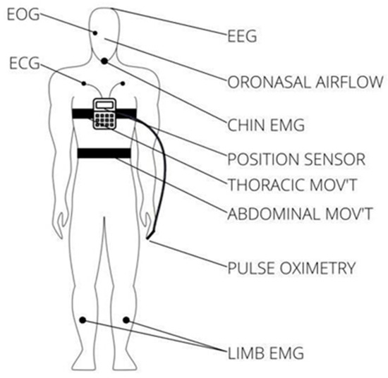 Advancements in Home-Based Devices for Detecting Obstructive Sleep ... Advancements in Home-Based Devices for Detecting Obstructive Sleep ...