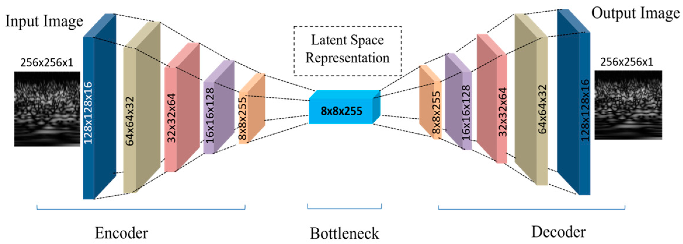 Sensors | Free Full-Text | Robust Epileptic Seizure Detection Using ...