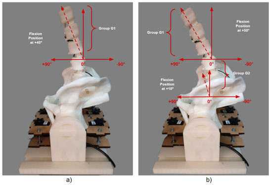 Fuzzy Controller Implemented for Movement of a Tendon-Driven 3D Robotic ...