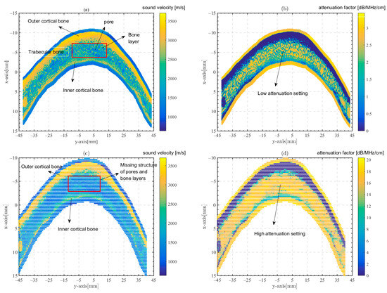 Transcranial Ultrasonic Focusing by a Phased Array Based on Micro-CT Images