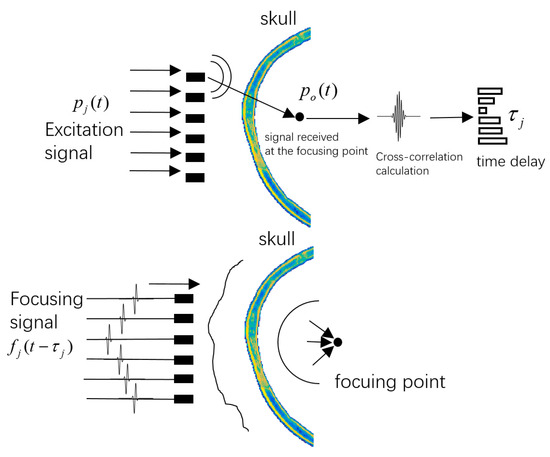 Transcranial Ultrasonic Focusing by a Phased Array Based on Micro-CT Images