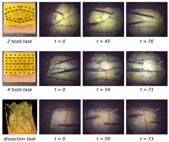 Endoscope Automation Framework with Hierarchical Control and Interactive Perception for Multi ...