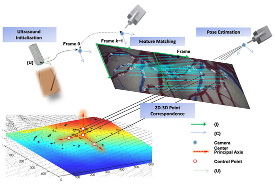 Sensors | Free Full-Text | Modern Image-Guided Surgery: A Narrative ...