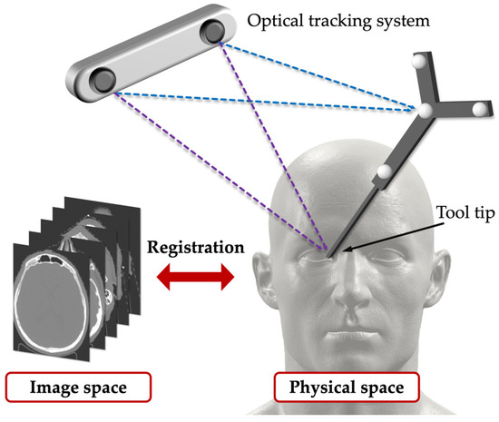 Modern Image-Guided Surgery: A Narrative Review of Medical Image ...