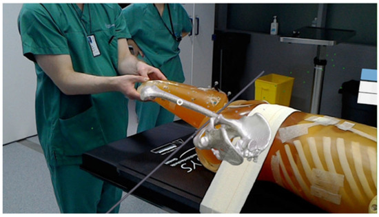 Sensors | Free Full-Text | Modern Image-Guided Surgery: A Narrative ...