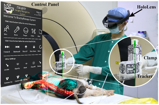 Sensors | Free Full-Text | Modern Image-Guided Surgery: A Narrative ...