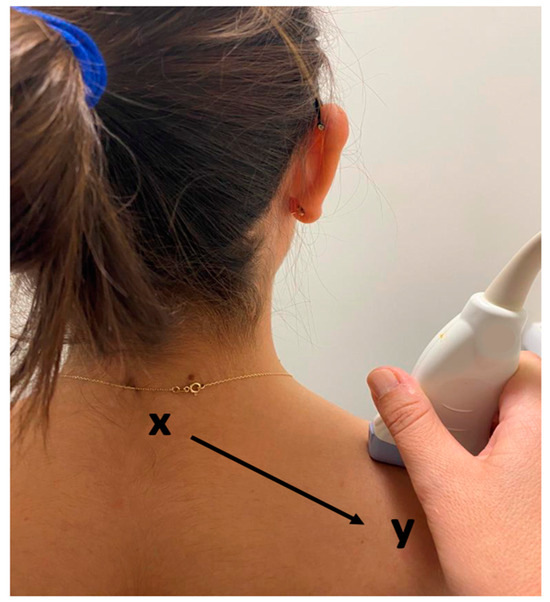 Identification of Myofascial Trigger Point Using the Combination of ...