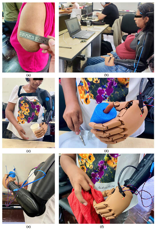 Sensors | Free Full-Text | The LIBRA NeuroLimb: Hybrid Real-Time ...