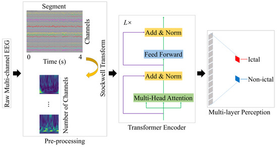 Automatic Seizure Detection Based on Stockwell Transform and Transformer