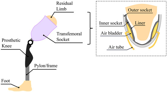 Sensors | Free Full-Text | A Pneumatically Controlled Prosthetic Socket for Transfemoral Amputees
