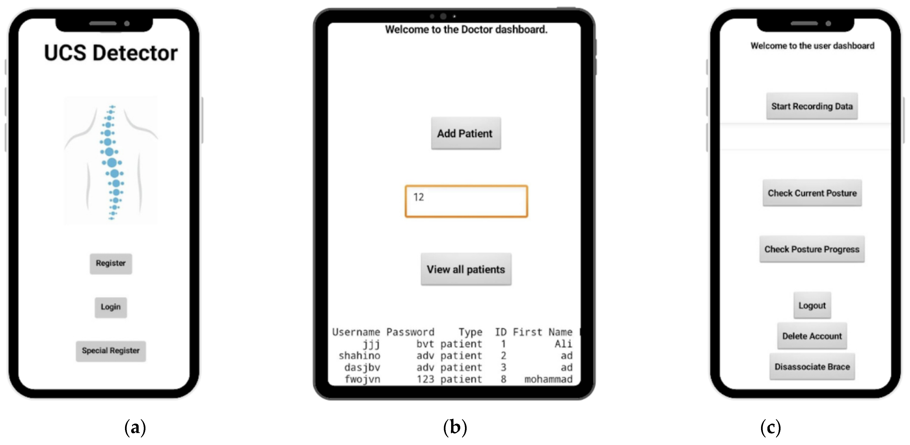 IoT-Based Solution for Detecting and Monitoring Upper Crossed Syndrome