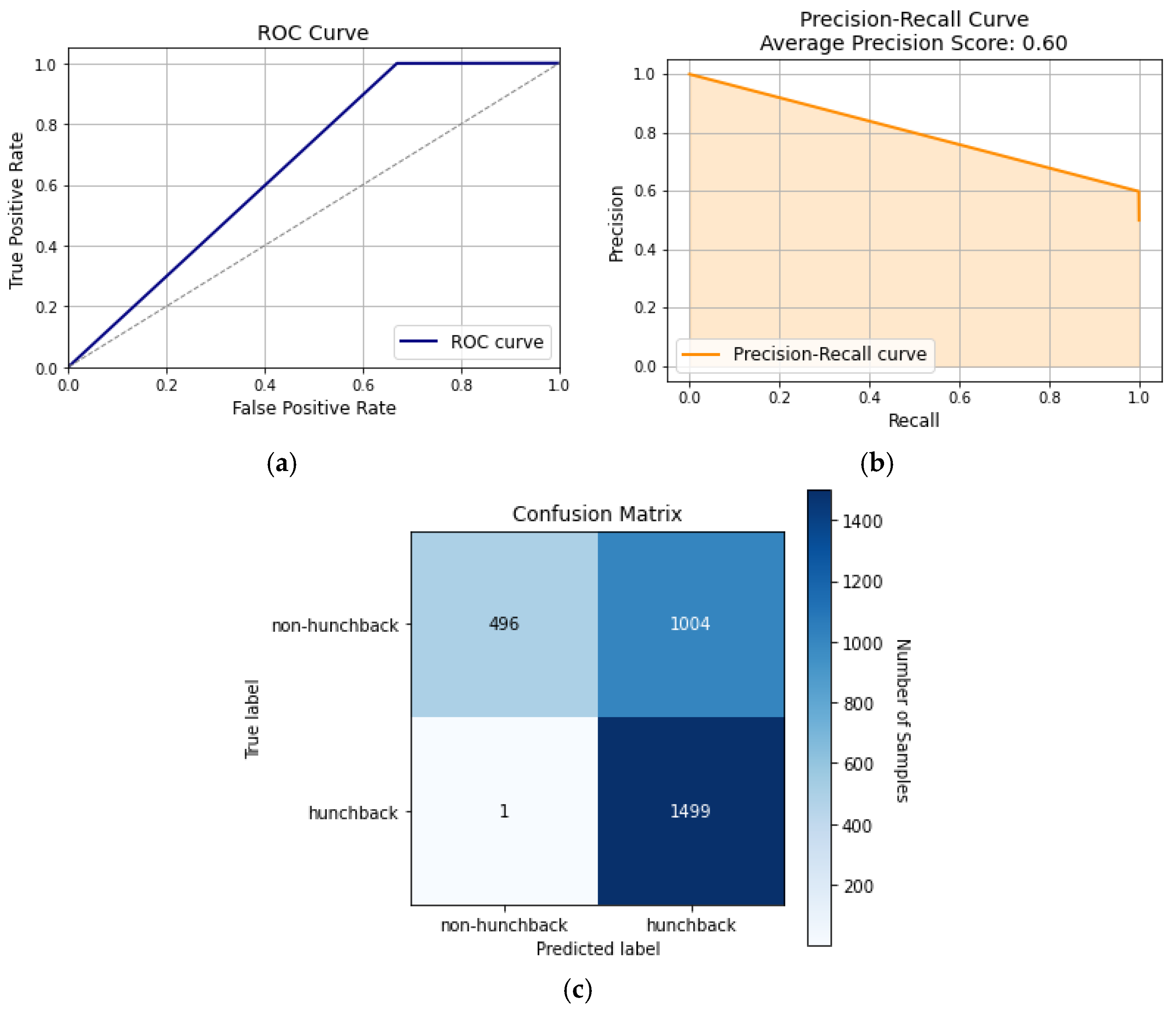 IoT-Based Solution for Detecting and Monitoring Upper Crossed Syndrome