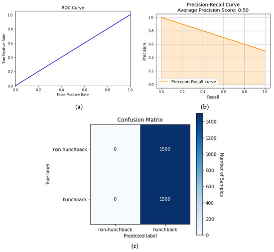 IoT-Based Solution for Detecting and Monitoring Upper Crossed Syndrome