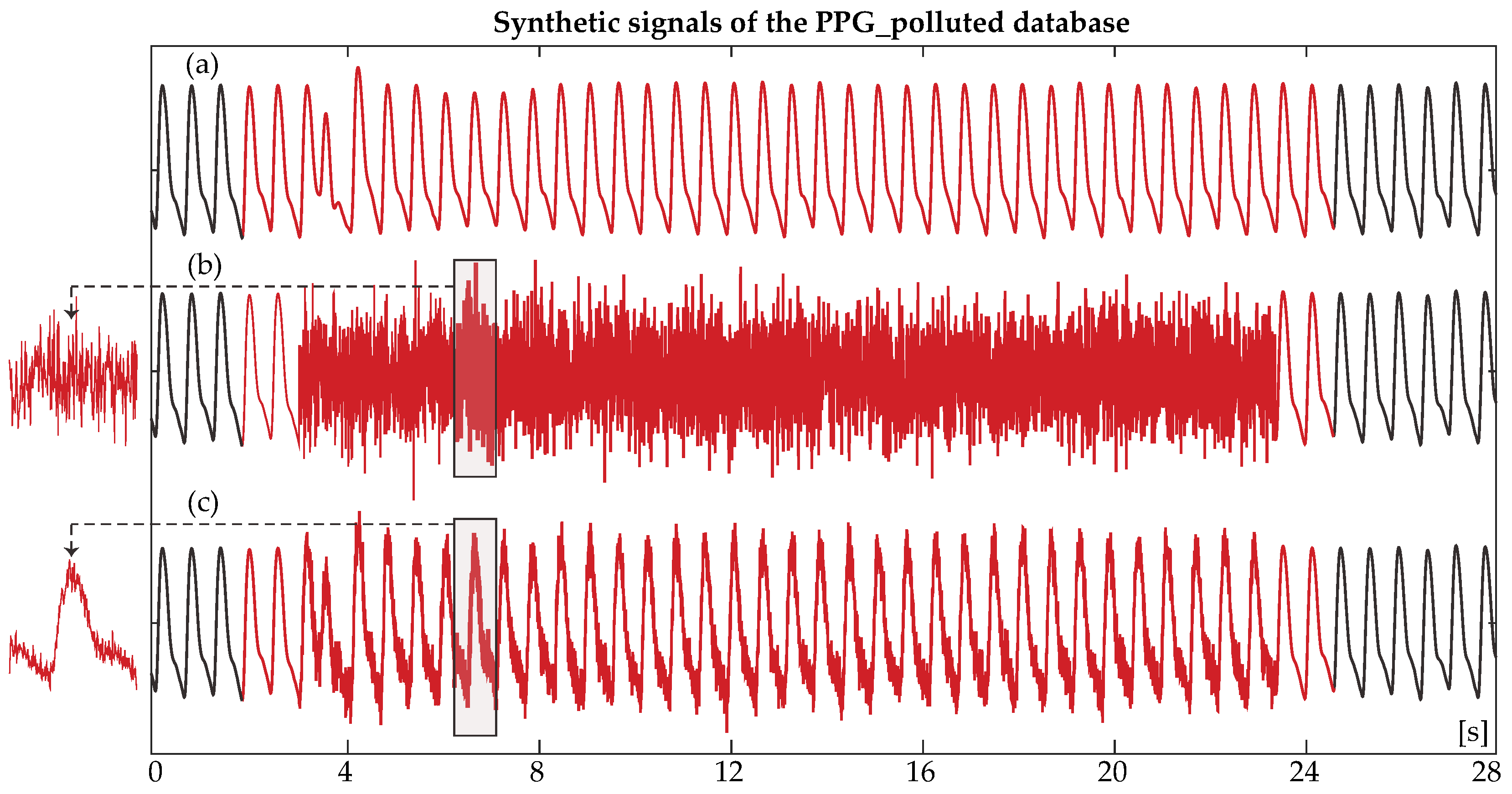 Sensors | Free Full-Text | A Novel Signal Restoration Method of Noisy Photoplethysmograms for ...