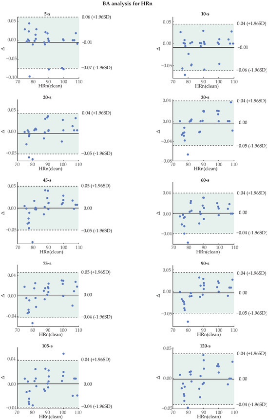 Sensors | Free Full-Text | A Novel Signal Restoration Method of Noisy Photoplethysmograms for ...