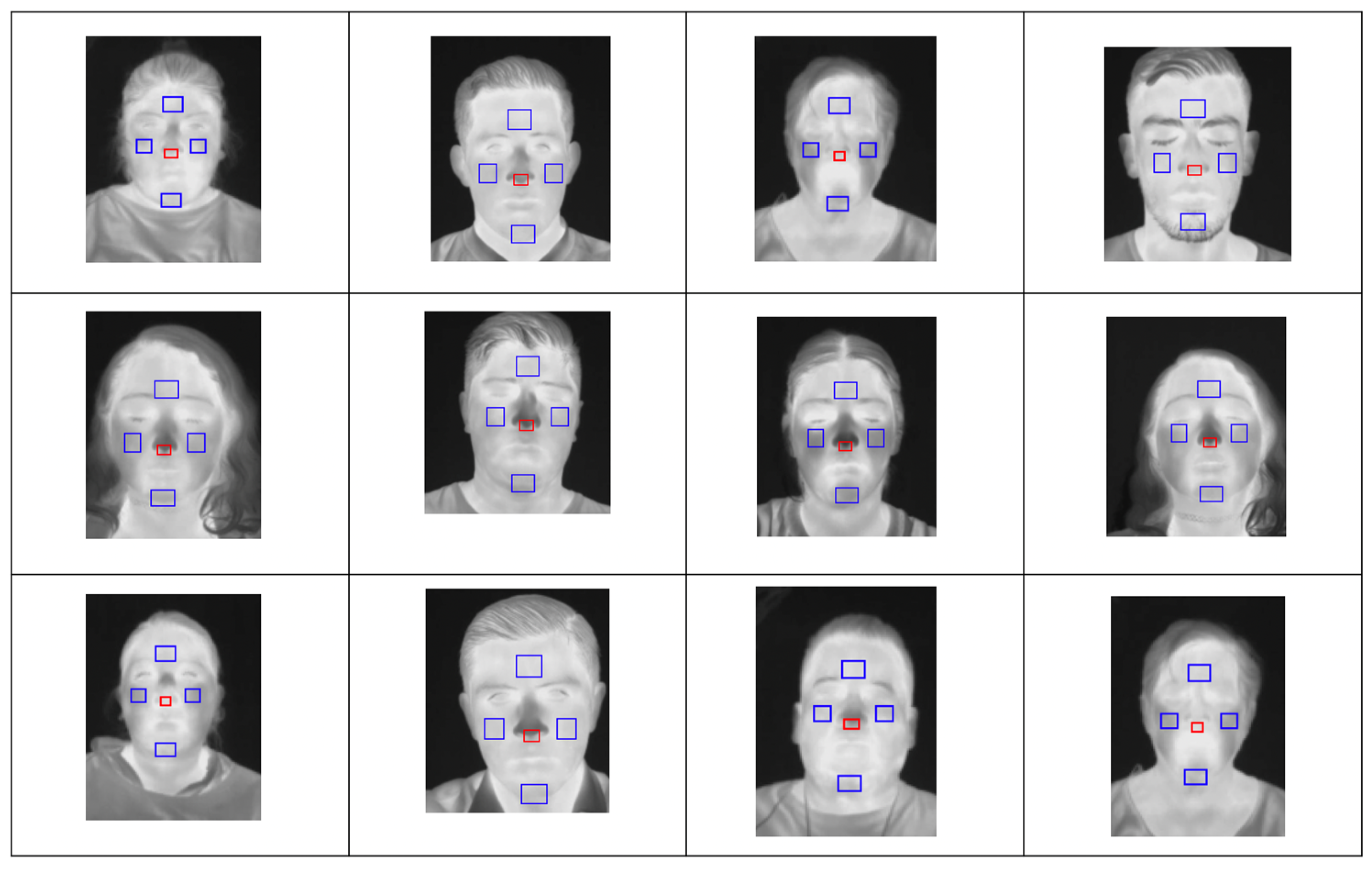 Automatic Segmentation of Facial Regions of Interest and Stress ...