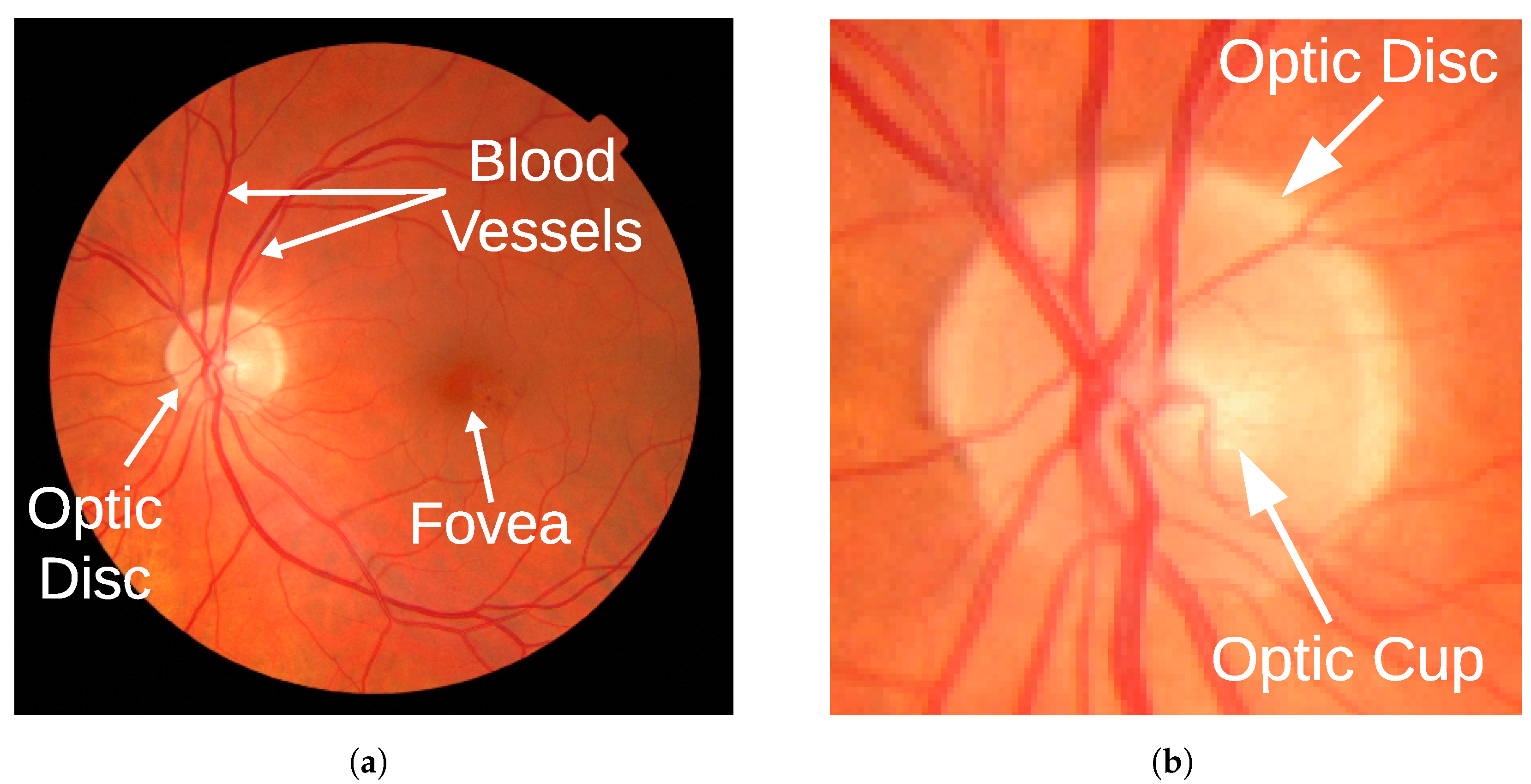 In-Depth Evaluation of Saliency Maps for Interpreting Convolutional ...