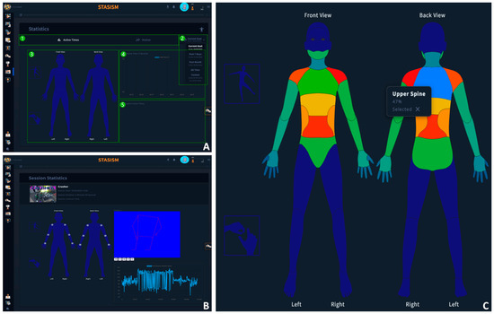 STASISM: A Versatile Serious Gaming Multi-Sensor Platform for ...