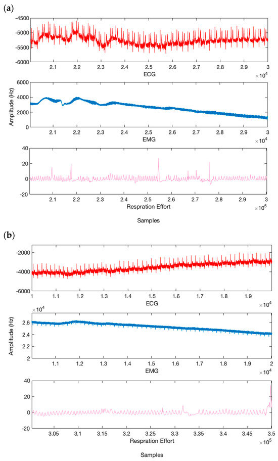 A Novel Approach for Automatic Detection of Driver Fatigue Using EEG Signals Based on Graph ...