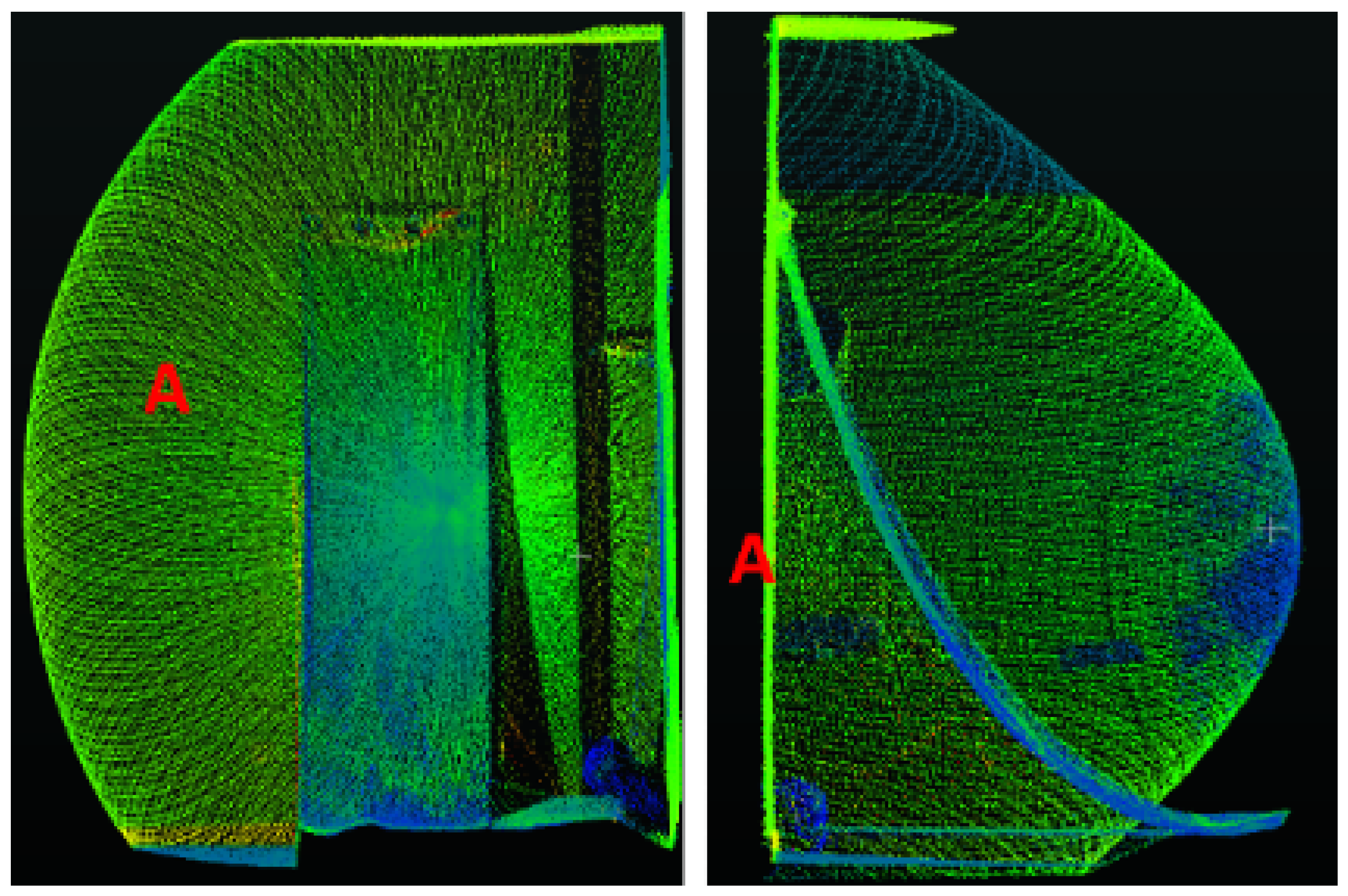Non-Repetitive Scanning LiDAR Sensor for Robust 3D Point Cloud Registration in Localization and ...