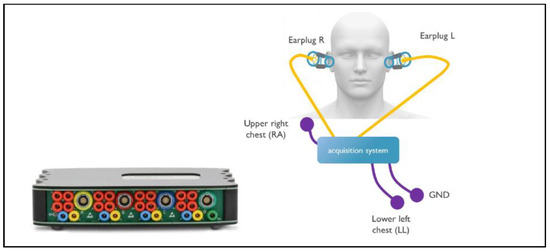 Multi-Channel Soft Dry Electrodes for Electrocardiography Acquisition ...